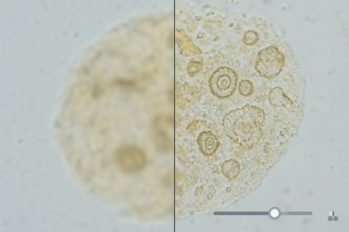 Abbe-Limit einfach erklärt: Auflösung vs. Vergrößerung